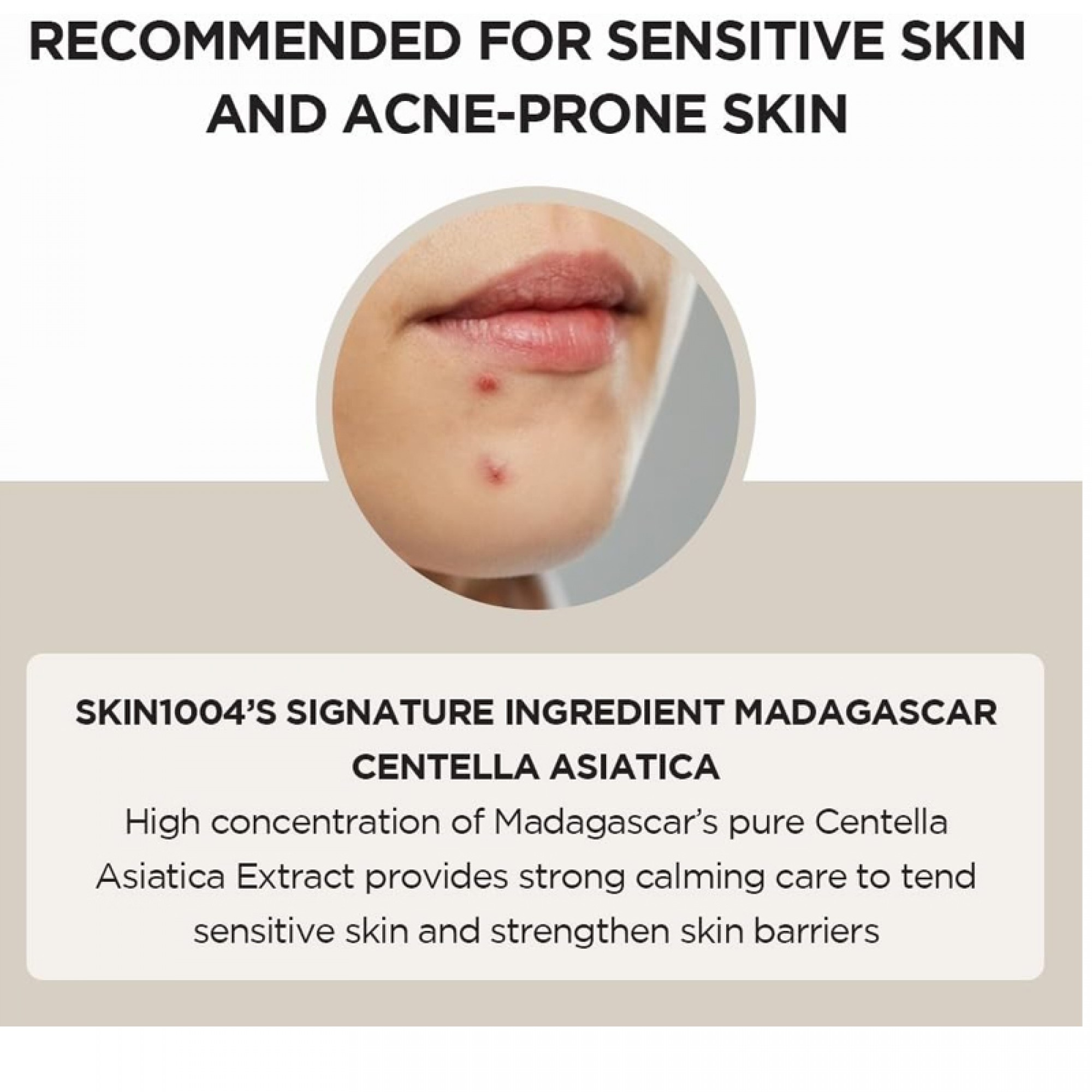 SKIN1004 Madagascar Centella Asiatica Ampoule Facial Serum 55ml,