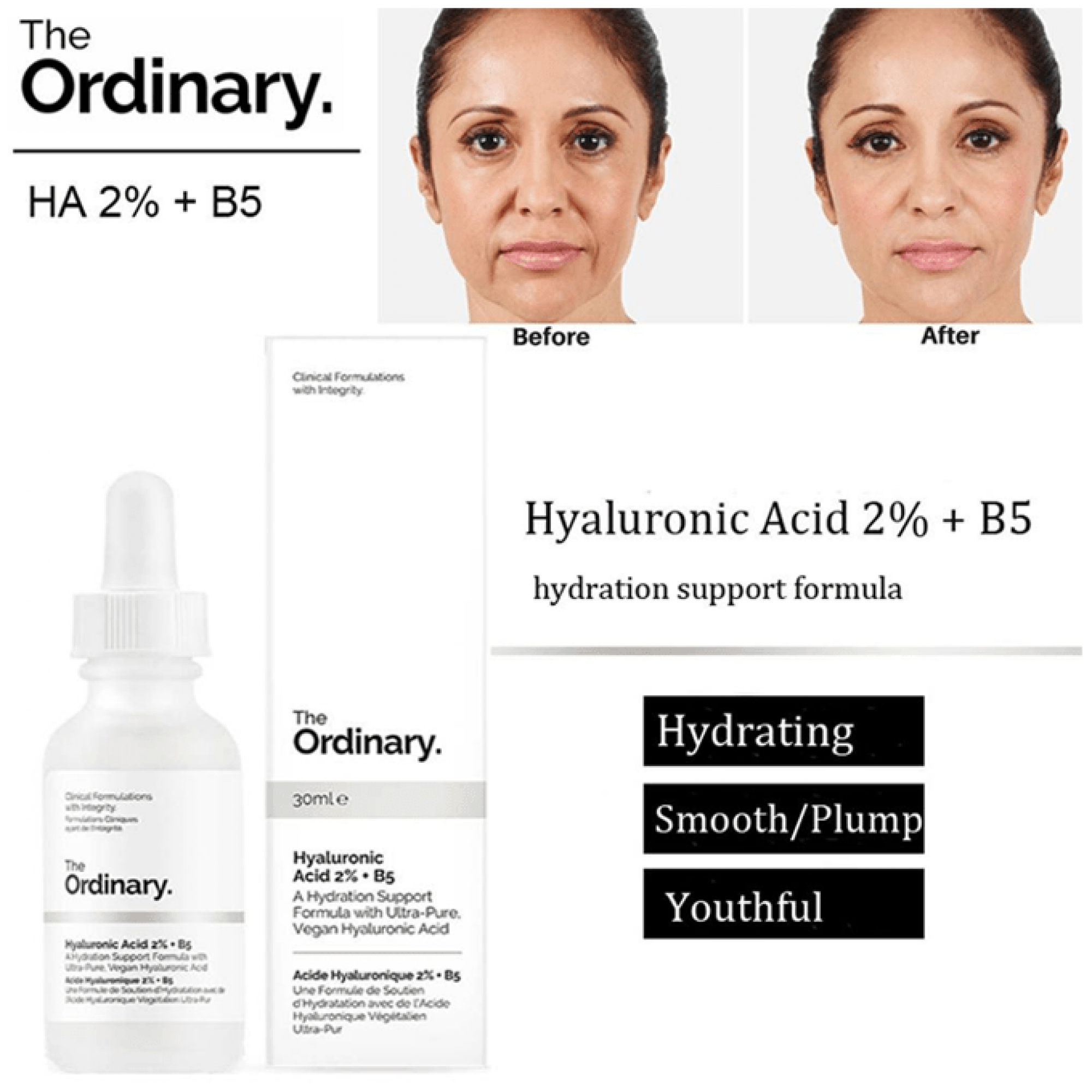 The Ordinary Hyaluronic Acid 2% + B5 - 30ml