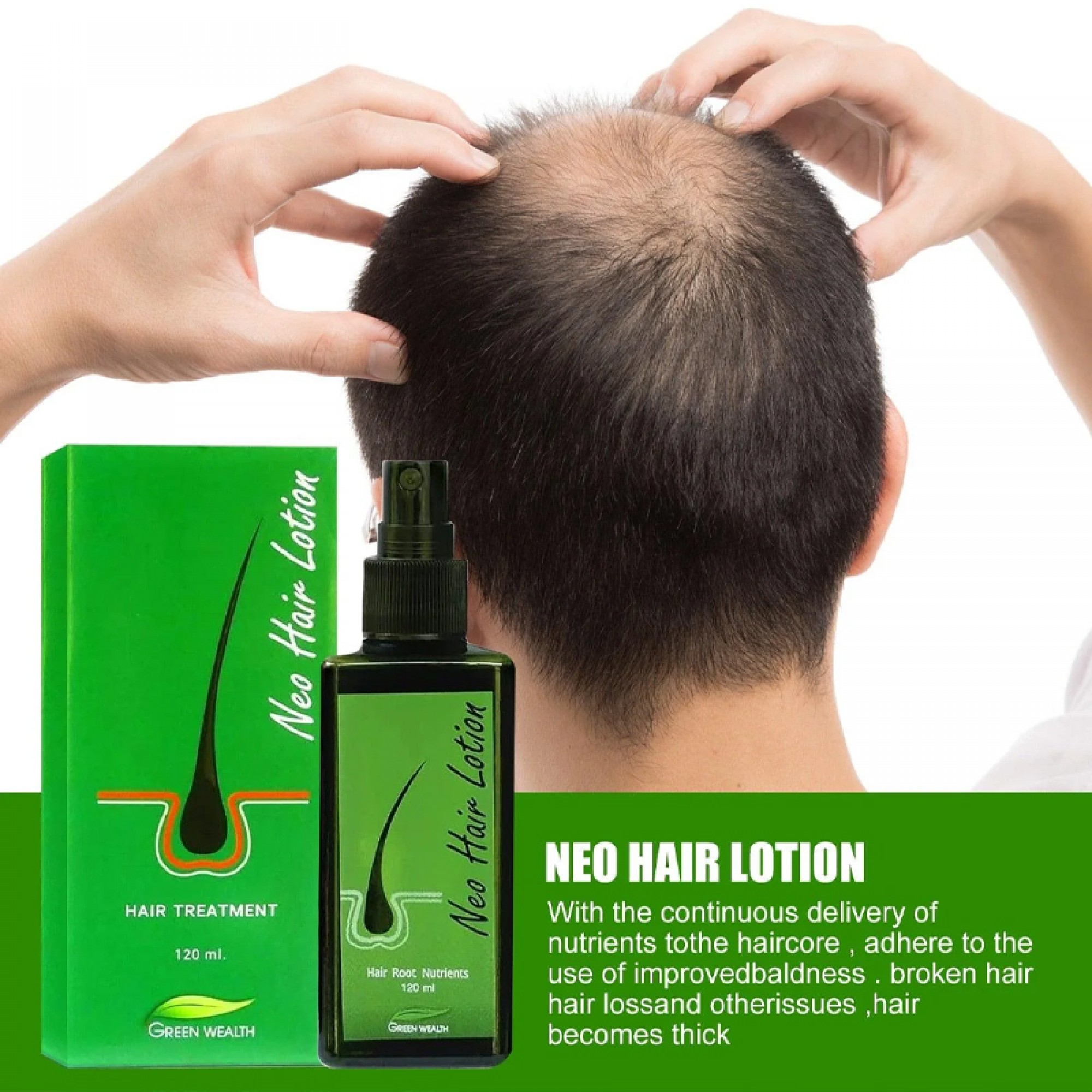 Green Wealth Neo Hair Lotion Hair Treatment - 120ml