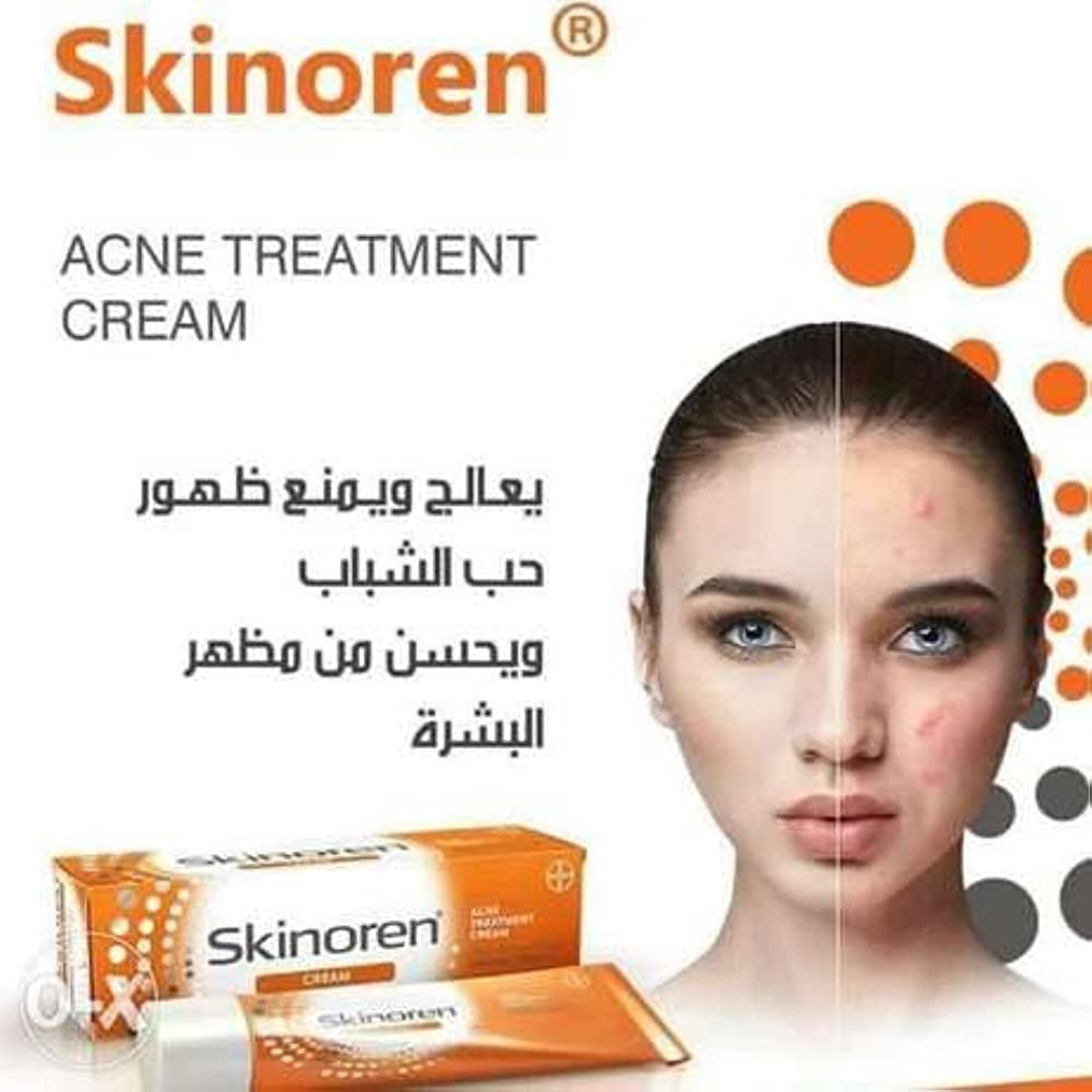 Skinoren cream for whitening, melasma and acne treatment 30 gm