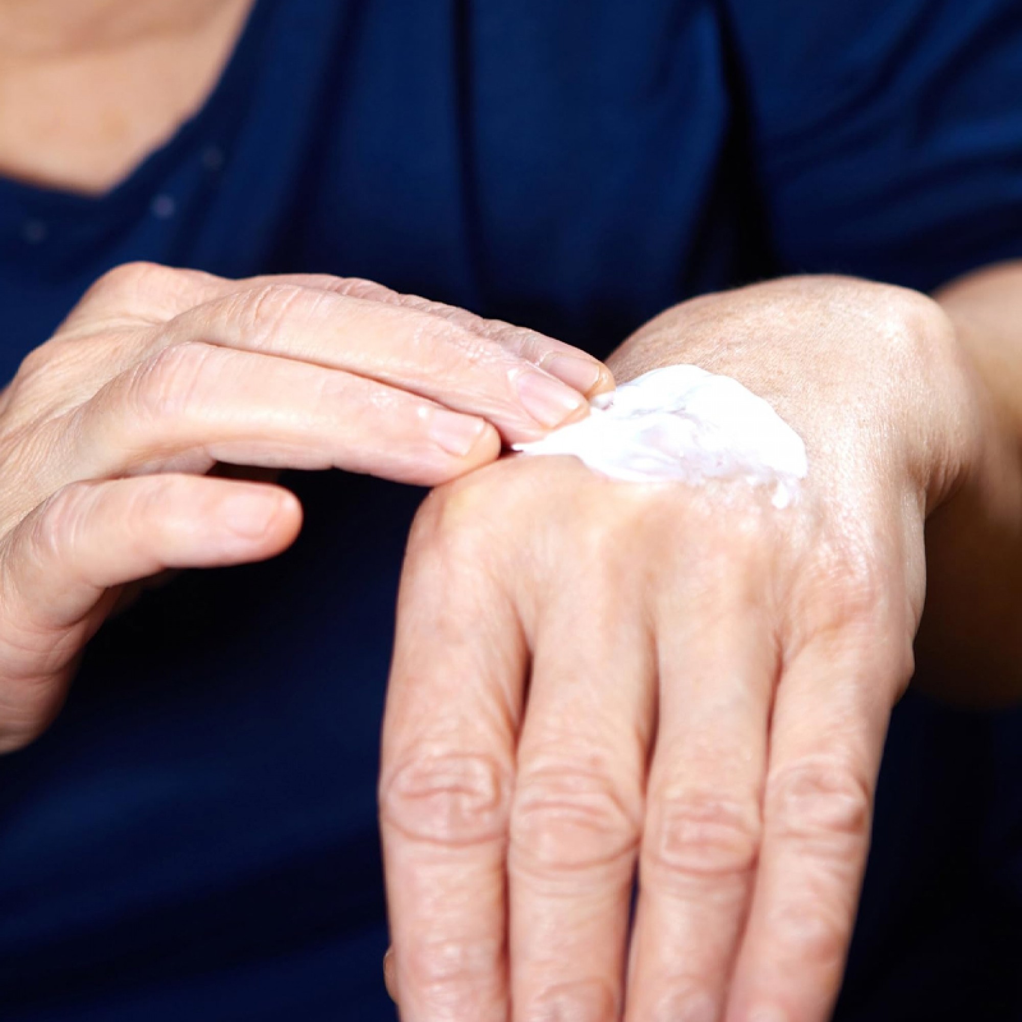 Advanced Clinicals Dark Spot Therapeutic Cream, 8oz Tube (8fl. oz)