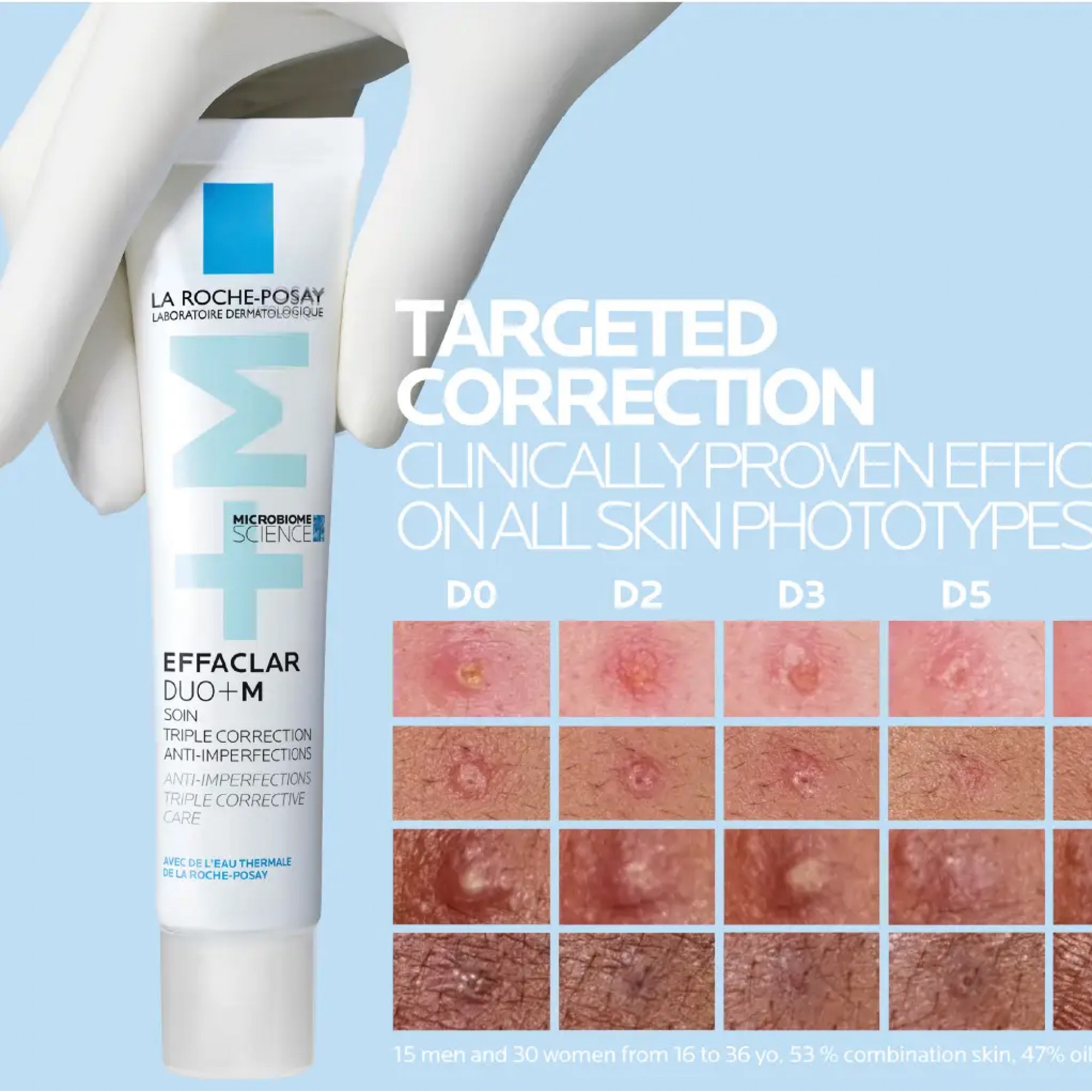 La Roche Posay Effaclar Duo+M Acne Treatment Cream Oily & Acne Prone ...