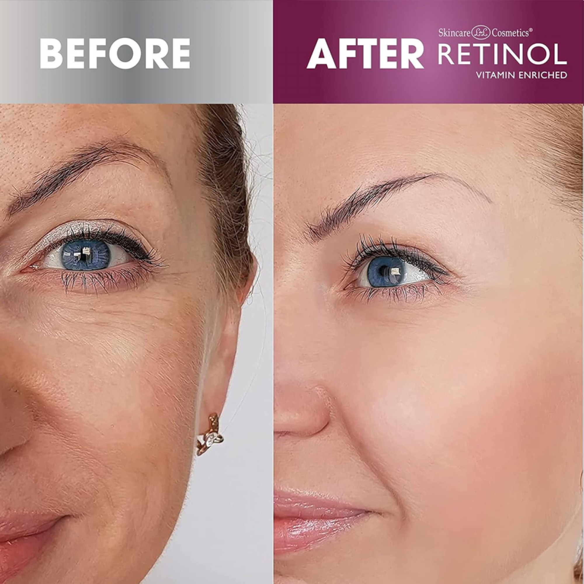 Retinol Super Daily Face Firming & Wrinkle Correction Cream 30g